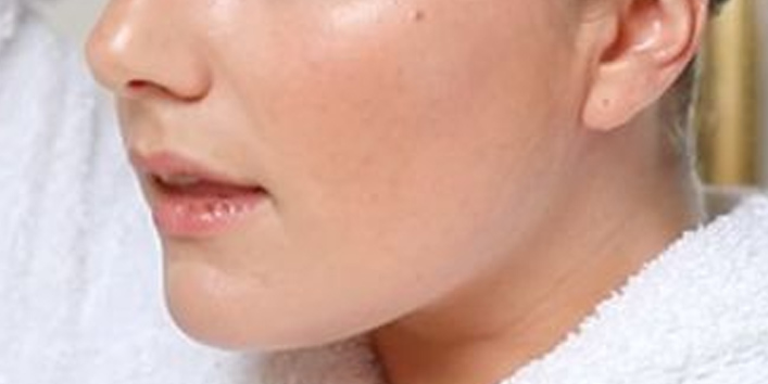 How to Prevent Congested Skin? How to Prevent Congested Skin?